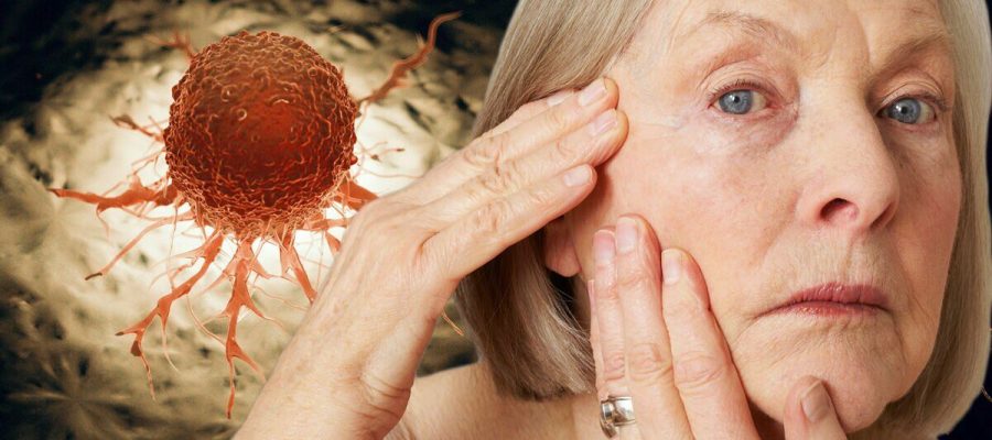 Cancer: Two warning signs known to show up in the face - they’re ...