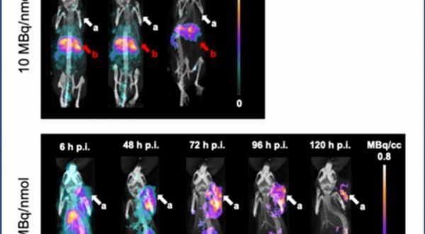 New imaging method superior for diagnosing multiple types of cancer, with potential for targeted ...
